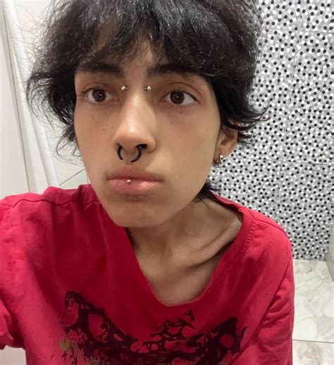 Aug 🪱 On X I Think My Tooth Is Too Big And It Seems That They Dont