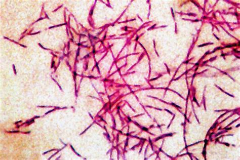 Legionnaires Disease Cluster Source In New York City Eliminated