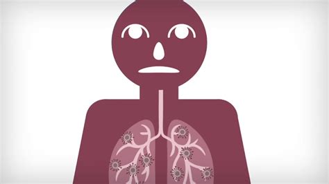 Coronavirus Symptoms Prevention And Number Of Covid 19 Cases In The