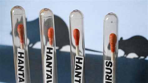 Is The Hantavirus In The Us Update Amid 2026 Cruise Ship Chaos