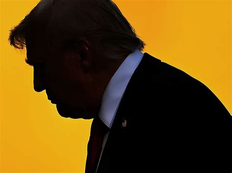 Trump S Chronic Venous Insufficiency Diagnosis Explained What To Know