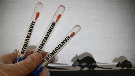 Hantavirus On The Hondius What We Know So Far Enca