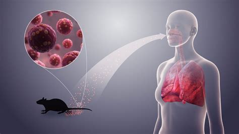 A Contained Hantavirus Outbreak And Lessons For The World
