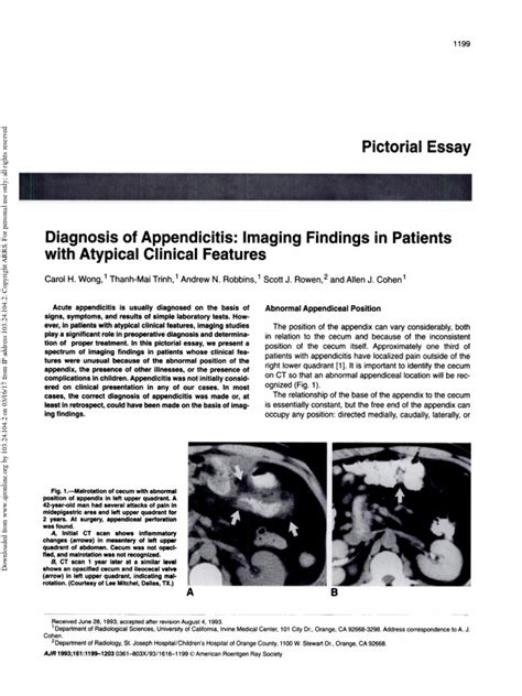Pictorial Essay Abnormal Appendiceal Position Pdf