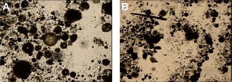 Microscopic Image Of The Tested Fly Ash Light Passing Through One