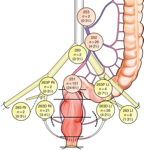 Prognostic Impact Of Residual Lateral Lymph Node Metastasis After Neoadjuvant Chemo