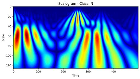 Github Samirelgehinyecg Af Classification Ecg Af Classification Is A Repository For Atrial