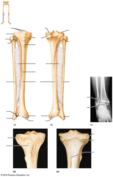 Tibia And Fibula Diagram Quizlet Tibia And Fibula Diagram Quizlet