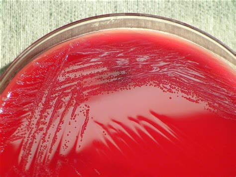Acinetobacter Em Agar Macconkey