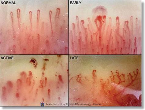 Microcirculation Video Microscope From Maikong Maikong Quantum