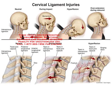 Medical Exhibits Demonstrative Aids Illustrations And Models