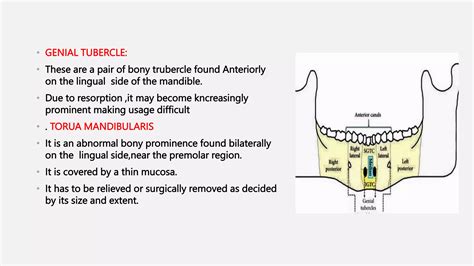Anatomical Landmarks In Mandible Pptx