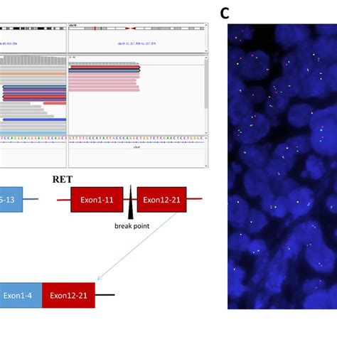 a integrated genomics viewer snapshot showing paired end sequencing