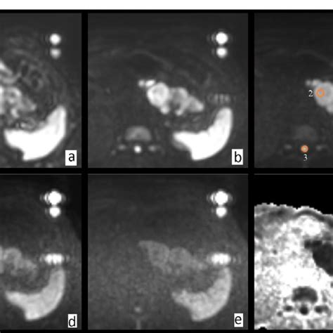 Four Diffusion Types Non Restricted Hindered Restricted With