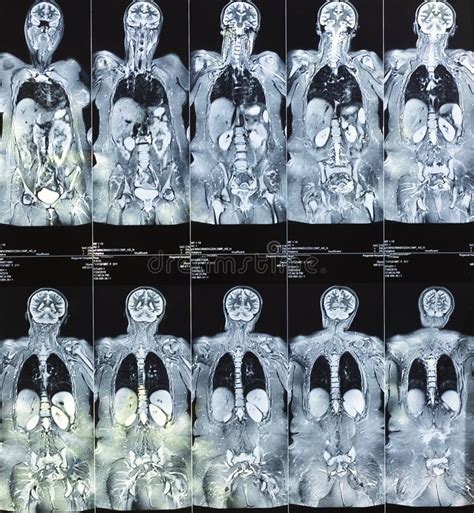 Magnetic Computer Tomography Stock Image Image Of Woman Female 320024867