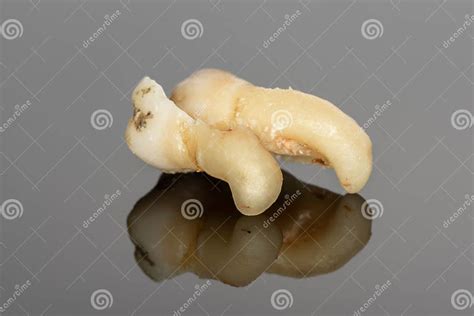 A Closeup Of A Sectioning Right Lower Third Molar With Curved Root Adult Tooth Number 48 Stock