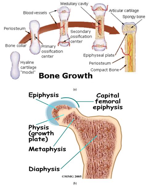 Baseline Thickness Of Proximal Femoral Epiphysis In The Diagnosis Of