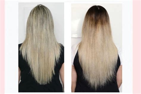 Biotina No Cabelo Antes E Depois Para Conhecer Seus Efeitos