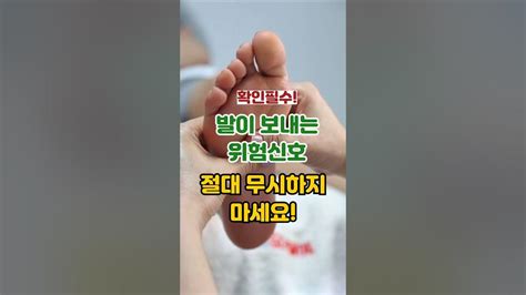 발이 보내는 위험 신호를 절대 무시하지 마세요 건강정보 건강정보 Youtube