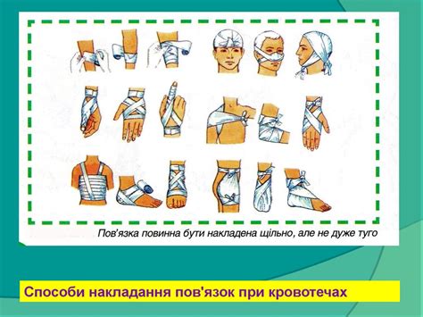 Надання першої домедичної допомоги потерпілим презентация онлайн