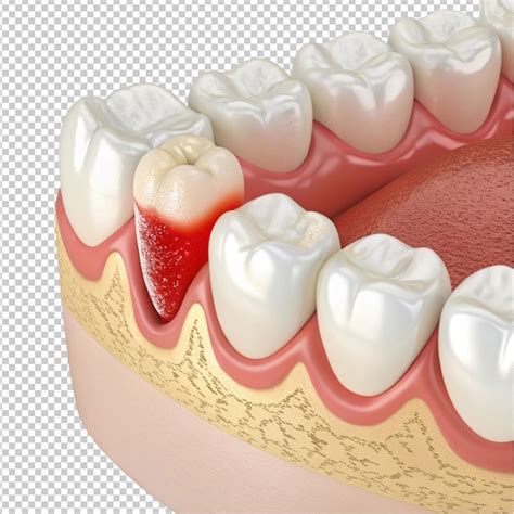 Page 2 Gingival Sulcus Psd High Quality Free Psd Templates For