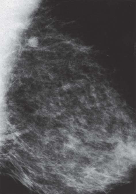 Case Demonstrations Oncohema Key