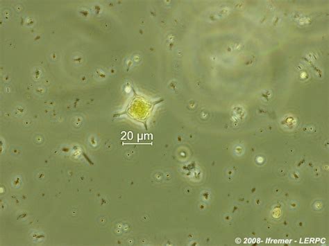 Dictyocha Unité Coast