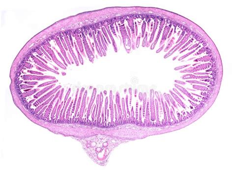 тонкий кишечник злой стоковое изображение изображение насчитывающей гистология 288379497