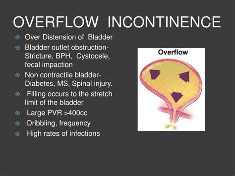 Overflow Incontinence Definition Qeryalive