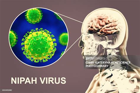 Encephalitis Caused By Nipah Viruses Illustration High Res Vector