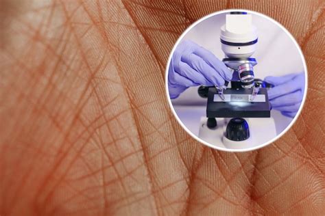 Decoding Skins Secrets Stem Cell Breakthrough At Cambridge Decoding Skins Secrets Stem Cell Breakthrough At Cambridge