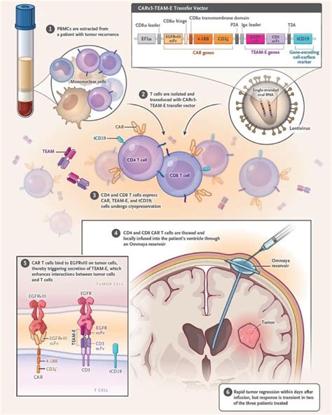 Glioblastoma Multiforme Is A Brain Tumor That Is Difficult To Treat And