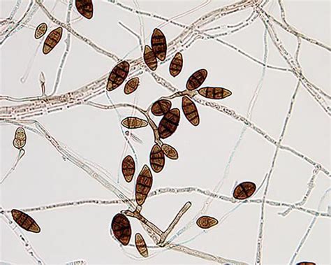 Ulocladium Etsy Italia Digital Image Etsy Color Photography