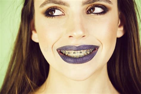 Braces And Lipstick Tumblr