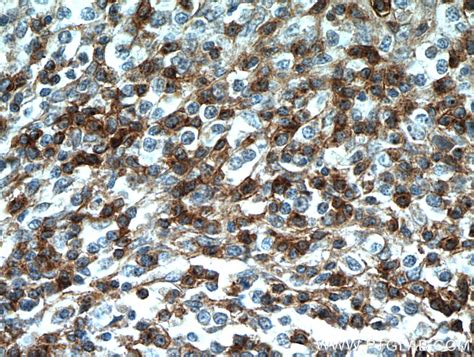 Cd7 Antibody 60209 1 Ig Proteintech