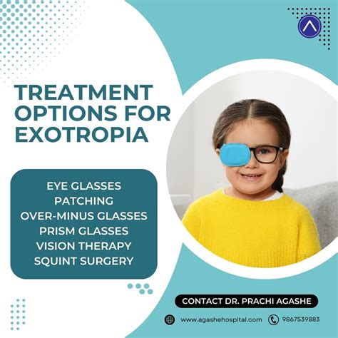 Exotropia Agashe Hospital