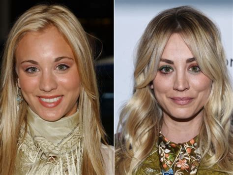 The Refreshing Reason Kaley Cuoco Is Proud Of Her Plastic Surgery