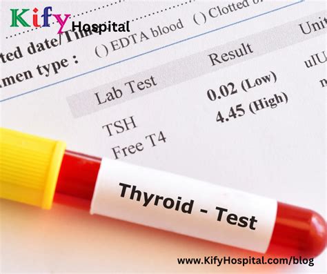 How To Read A Thyroid Test Report A Simple Guide For Patients