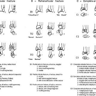 PDF Consistency Of AO Fracture Classification For The Distal Radius