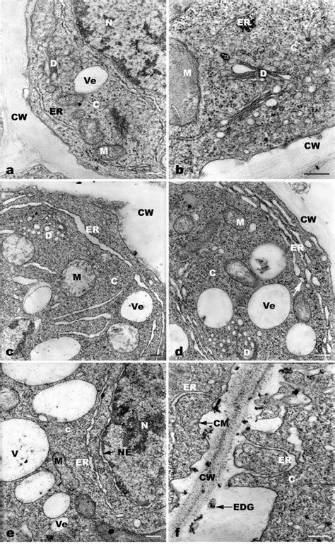 Tem Micrographs Showing Toxic Effects Of Pb On Ultrastructure Of The