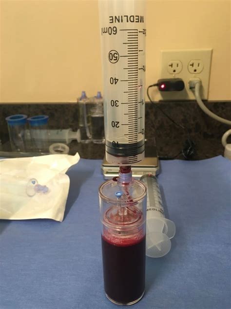 Owner Assessed Outcomes Following Elbow Arthroscopy With Or Without