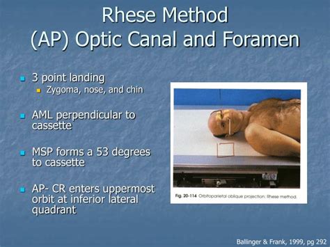 Ppt Radiography Of The Orbits Powerpoint Presentation Id5669687