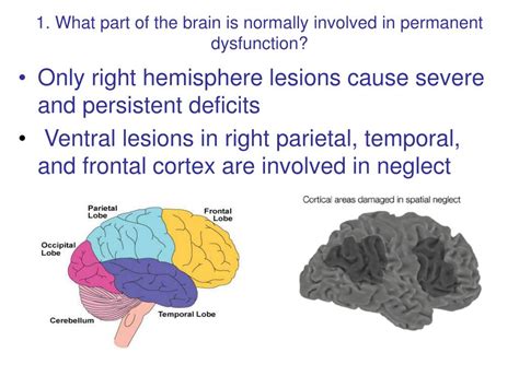 Ppt Spatial Neglect And Attention Networks Powerpoint Presentation Free Download Id 3385267