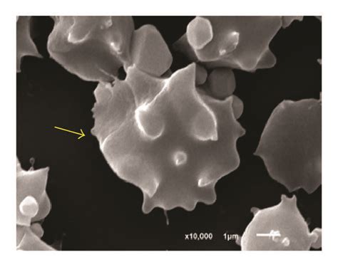 Scanning Electron Micrograph Of Dysmorphic Erythrocyte Induced By