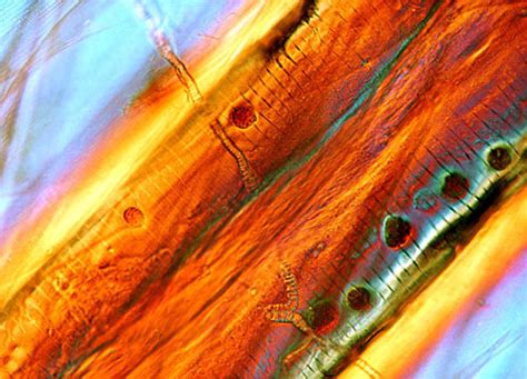 Moth Wing Nikons Microscopyu