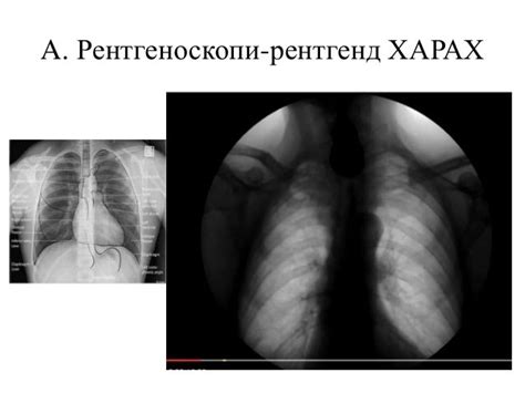 зүрх том судасны дүрс оношлогоо
