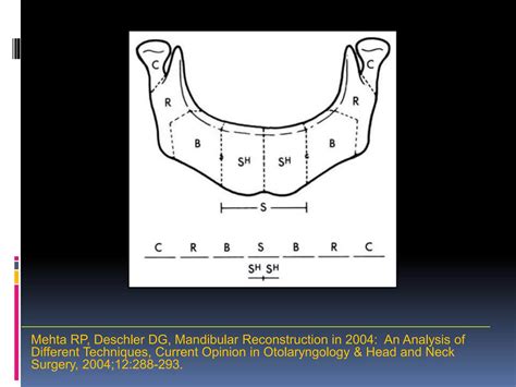 Prosthodontic Rehabilitation Of Mandibulectomy Pptx
