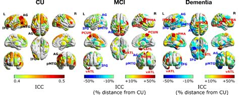 The Functional Reconfiguration Of Fingerprints During Cognitive