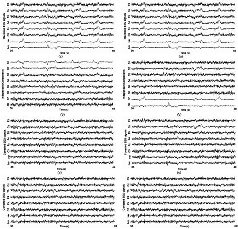 A Portion Of Measured Eeg Signals B Extracted Independent