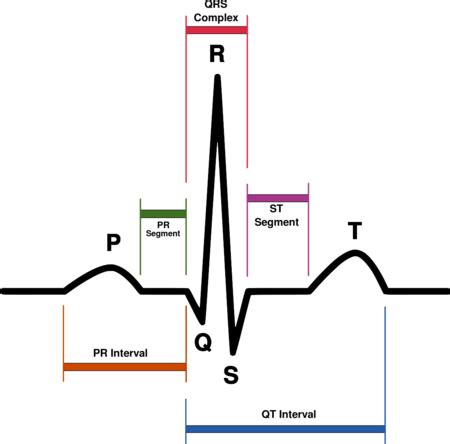 QT Prolongation WikEM